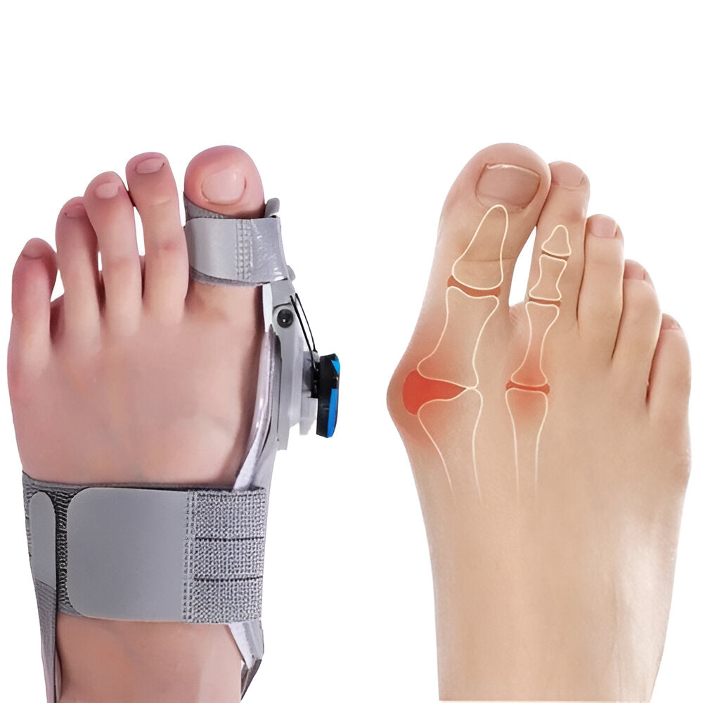 Ergonomic Toe Spacer for Bunions Correction and Support – Feanatic